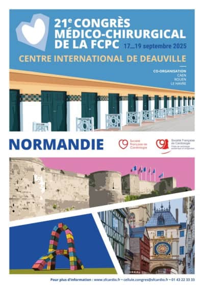 France TAVI - SFCARDIO