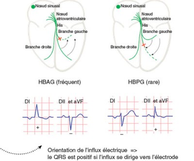 Chapitre 15 - Item 231 : Électrocardiogramme : indications et ...