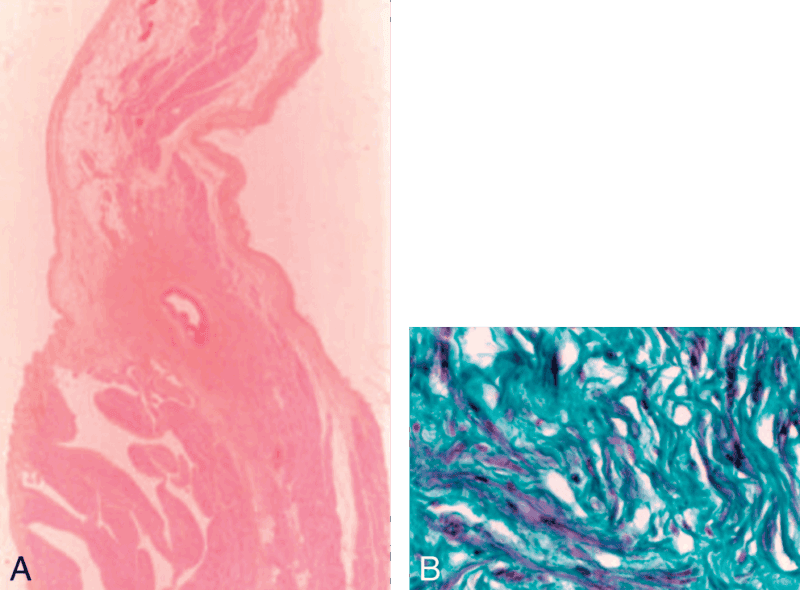 Chapitre 6 - Électrophysiologie - SFCARDIO